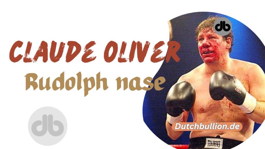 Claude Oliver Rudolph Nase Krankheit: Kontroverse oder einzigartiges ...